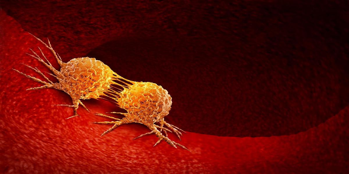 Janssen to Advance Oncology Treatment with Elektrofi in $155 Million ...