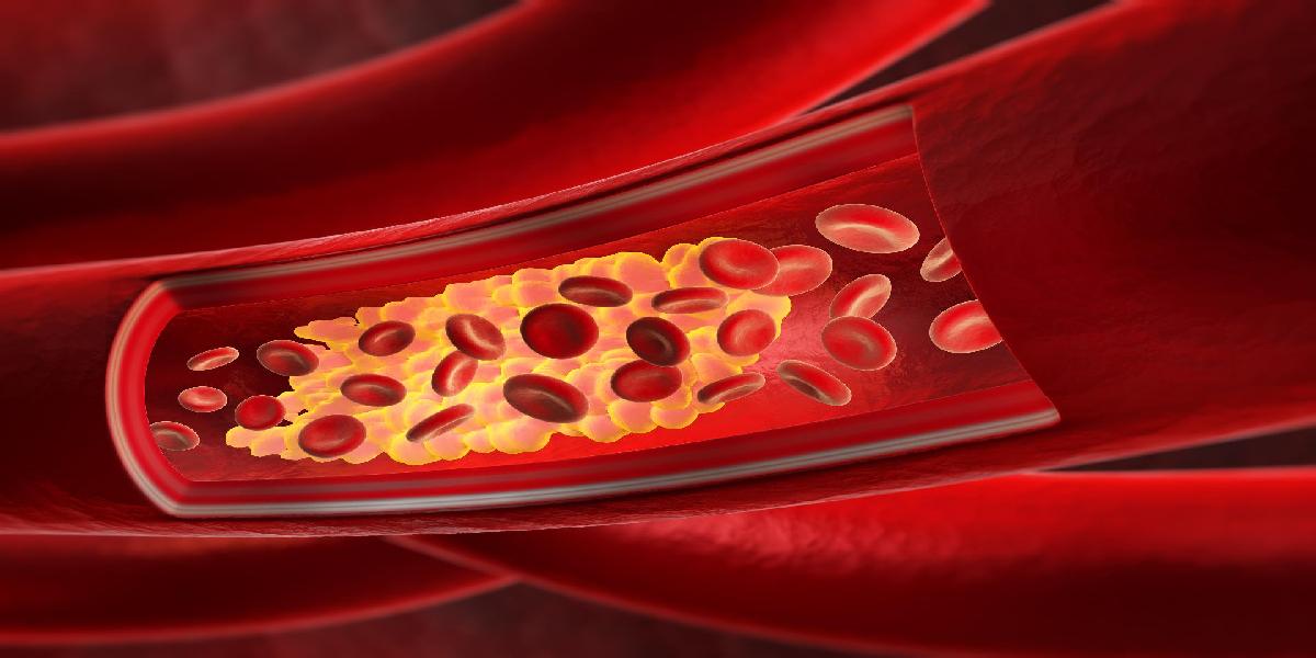 XyloCor Therapeutics secures global license for SmartWise’s Extroducer ...